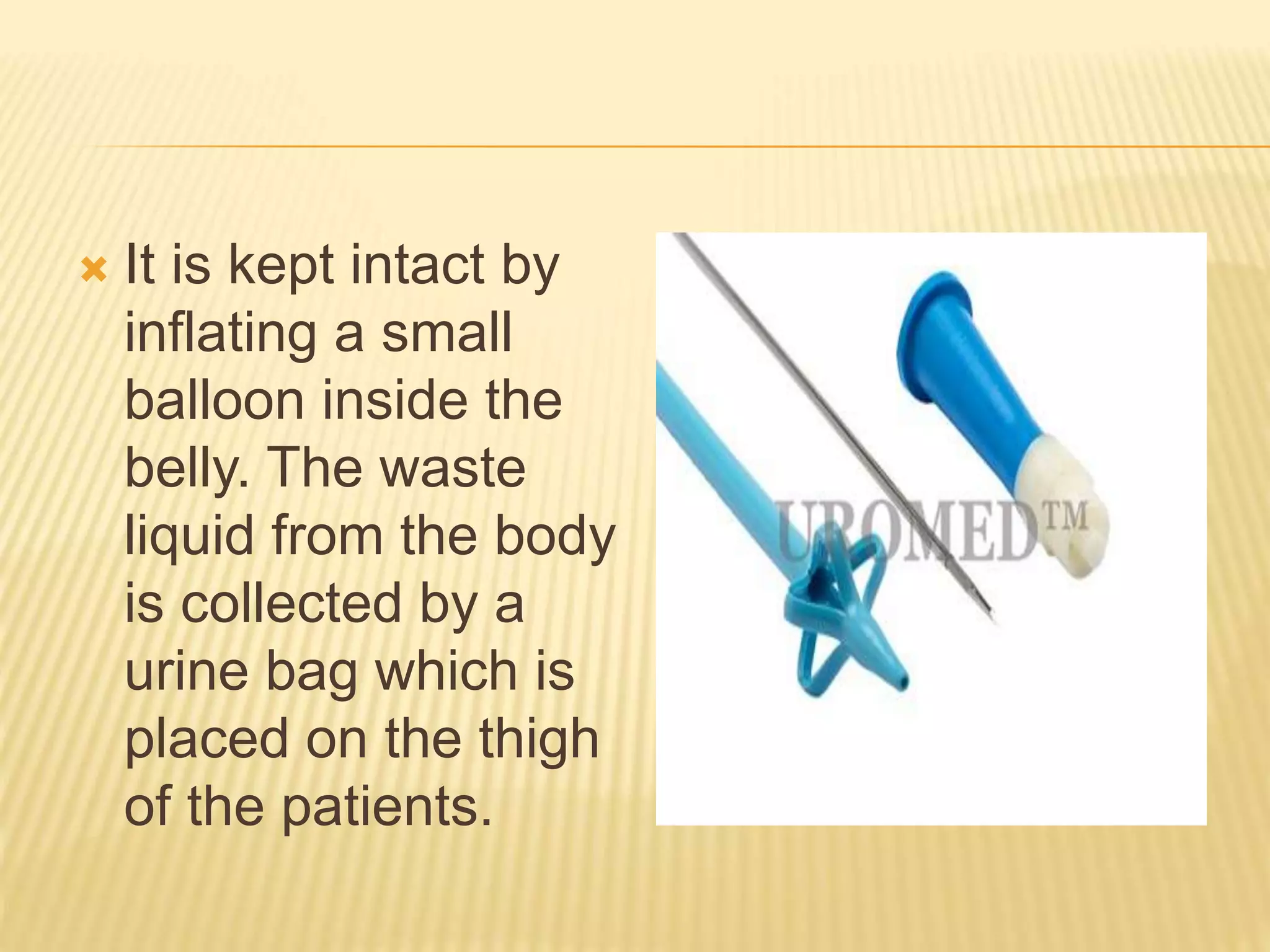 Suprapubic catheters | PPTX