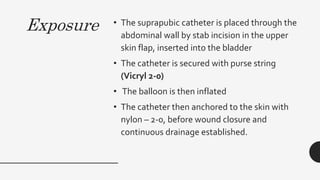 Supra pubic cystostomy | PPTX