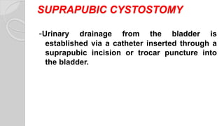 Supra pubic cystostomy | PPTX