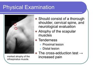 Suprascapular nerve entrapment | PPT
