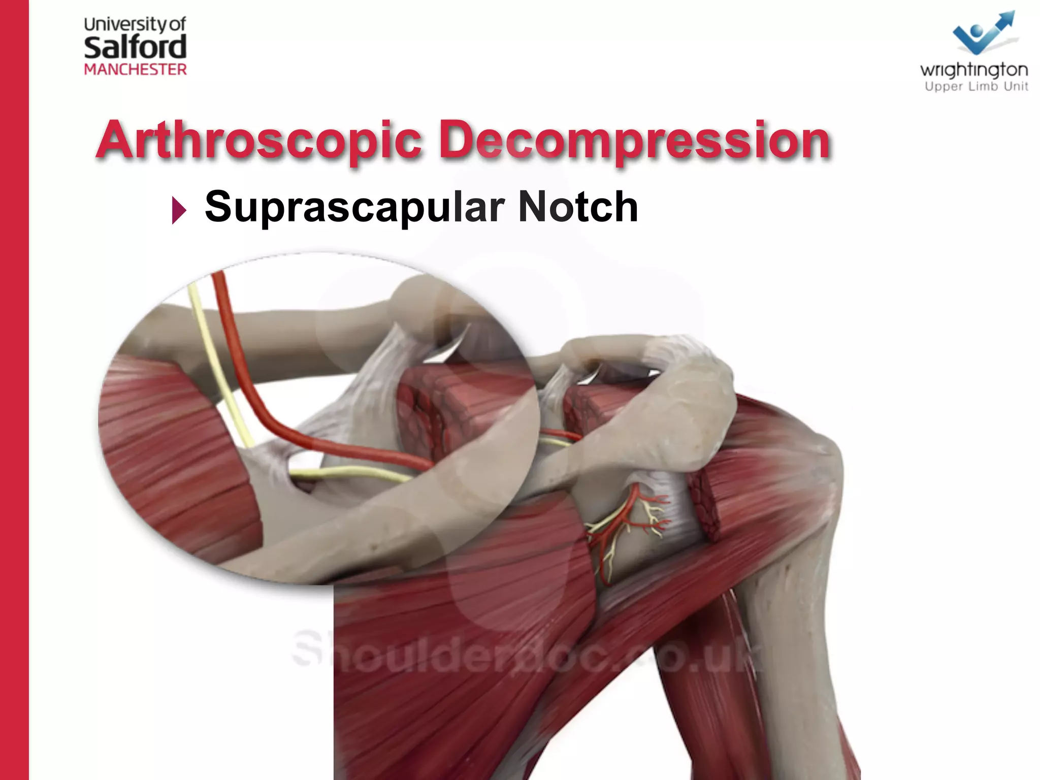 Suprascapular Nerve Palsy - Lennard Funk 2015 | PDF