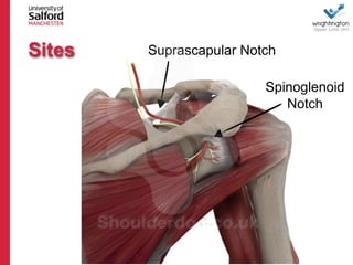 Suprascapular Nerve Palsy - Lennard Funk 2015 | PDF