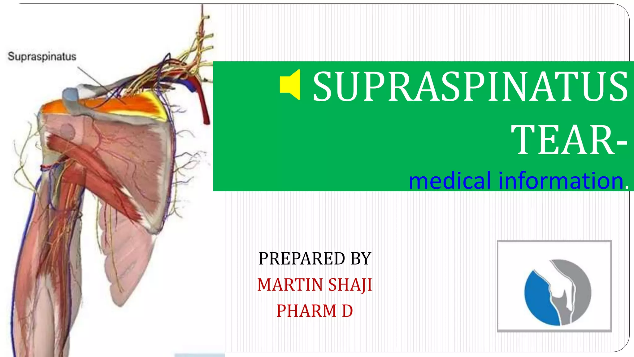 Supraspinatus tear - medial information | PPTX