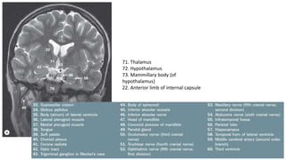 supratentorial area Imaging presantation.pptx