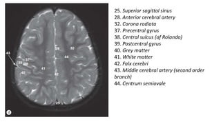 supratentorial area Imaging presantation.pptx