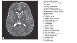supratentorial area Imaging presantation.pptx