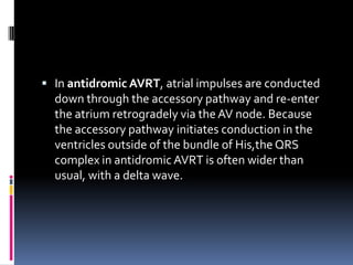 Supraventricular tachyarrythmias | PPTX