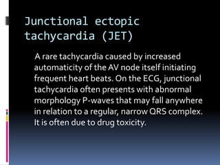 Supraventricular tachyarrythmias | PPTX