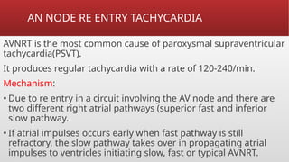 SUPRAVENTRICULAR TACHYCARDIA.pptx Slideshare | PPTX