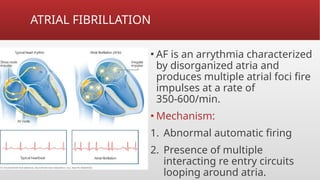 SUPRAVENTRICULAR TACHYCARDIA.pptx Slideshare | PPTX