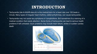 SUPRA VENTRICULAR TACHYCARDIA BY- DR. NASIR UDDIN | PDF