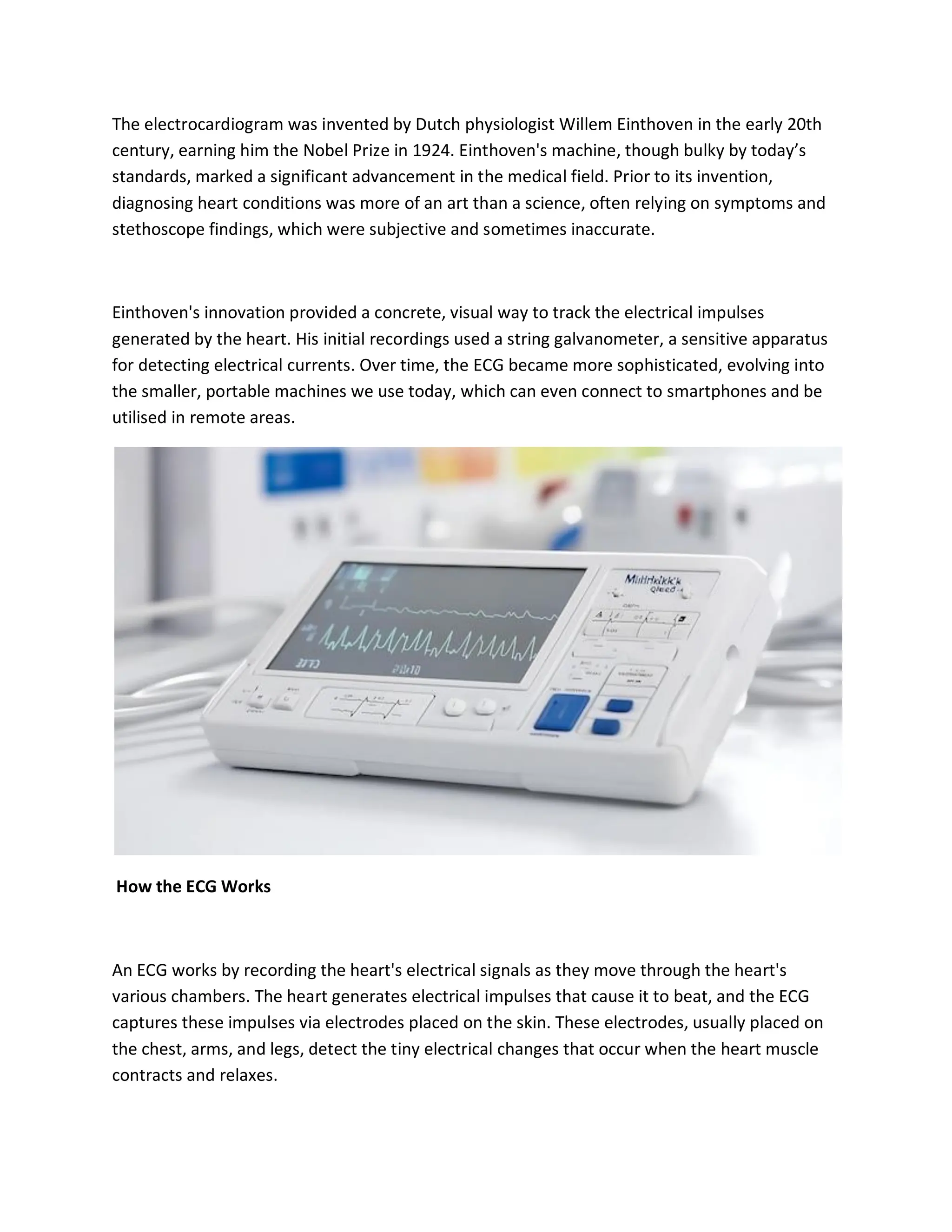 Supraventricular Tachycardia ECG: Invention, Functionality, and Its ...