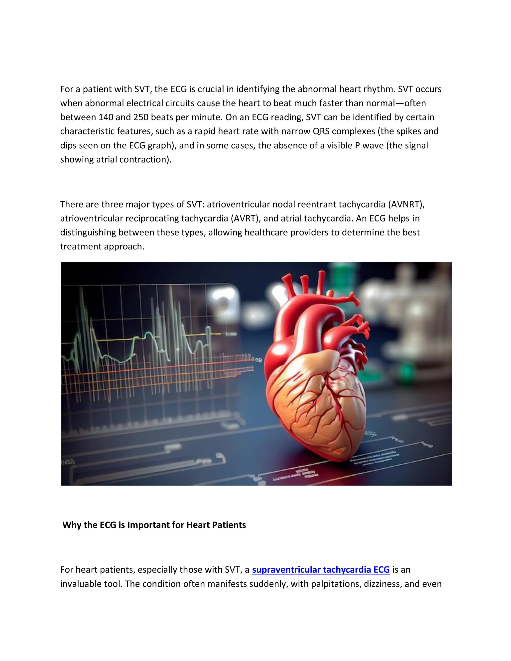 Supraventricular Tachycardia ECG: Invention, Functionality, and Its ...