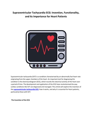 Supraventricular Tachycardia ECG: Invention, Functionality, and Its ...