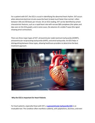 Supraventricular Tachycardia ECG: Invention, Functionality, and Its ...
