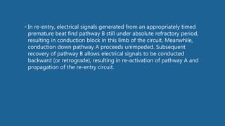 Supraventricular Tachycardias | PPTX