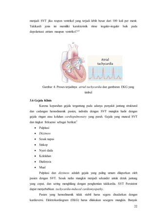 Supraventrikuler takikardi | DOCX