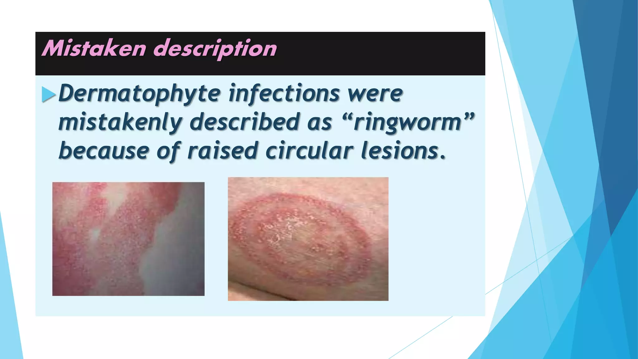 Fungal diseases(MYCOSES) | PPTX