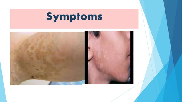 Fungal diseases(MYCOSES) | PPTX