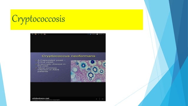 Fungal diseases(MYCOSES) | PPTX