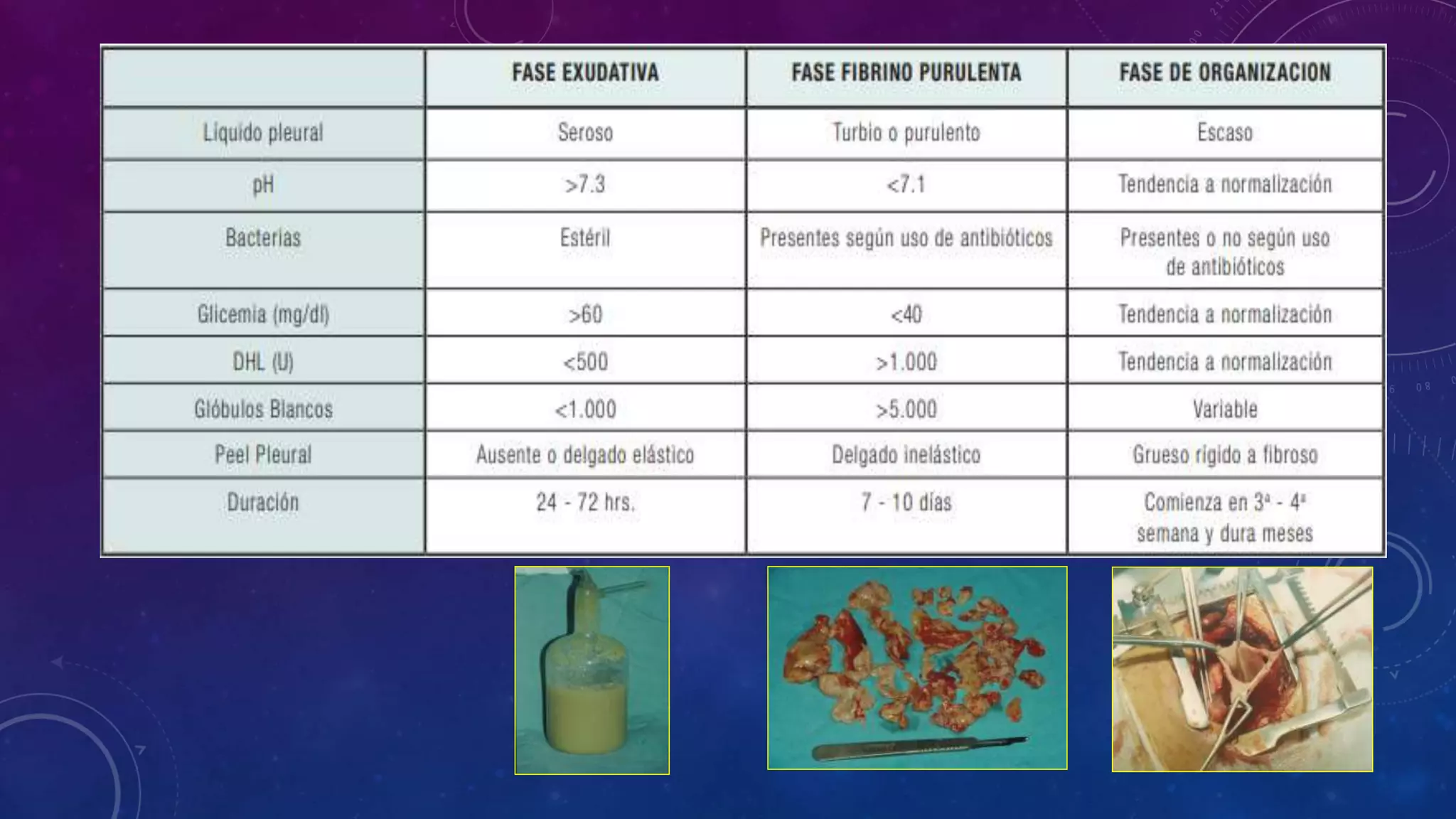 Supuraciones pleuropulmonares | PPT