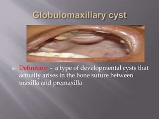 Non odontogenic cyst | PPTX