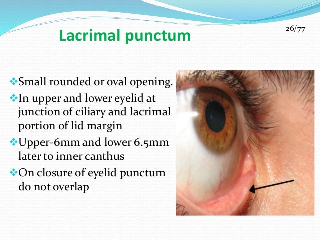 Suraj ..lacrimal appartus ppt (2)
