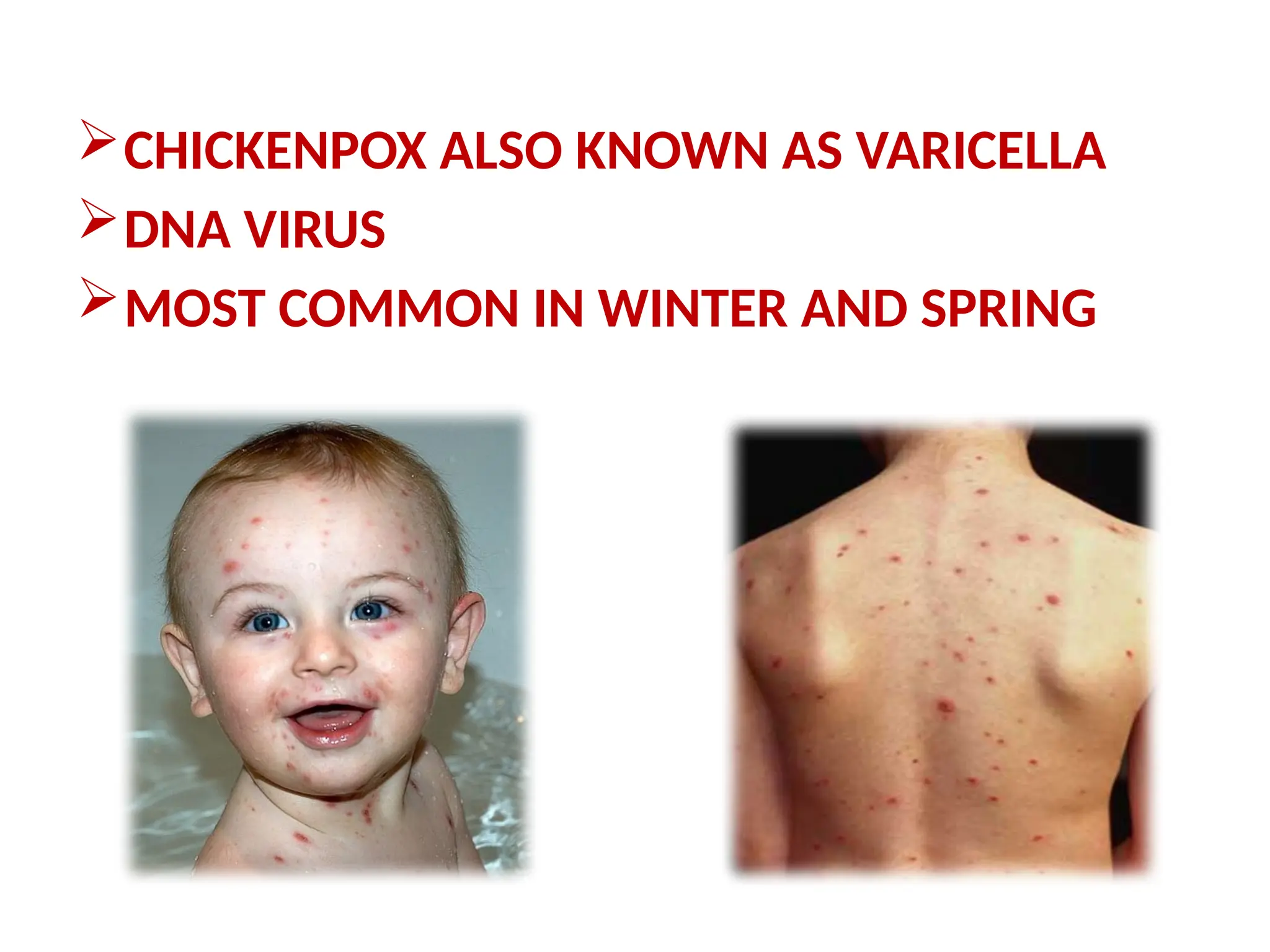 diseases chicken box suraj-170224155357.pptx