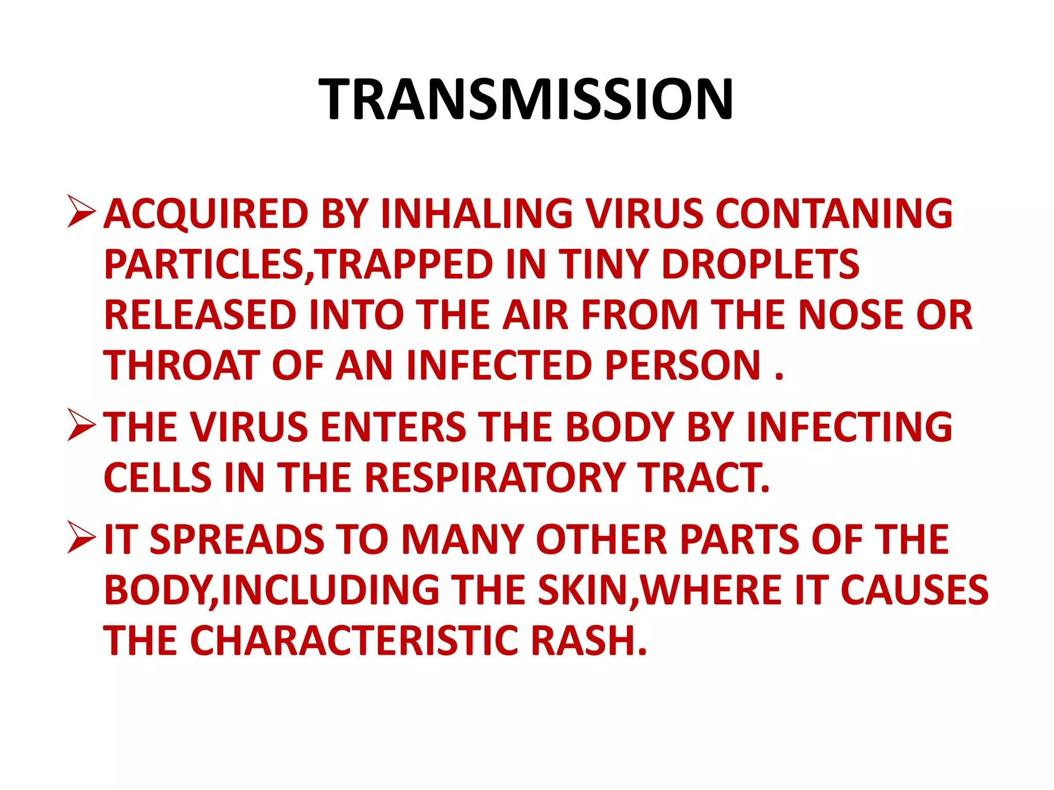CHICKENPOX ppt | PPTX