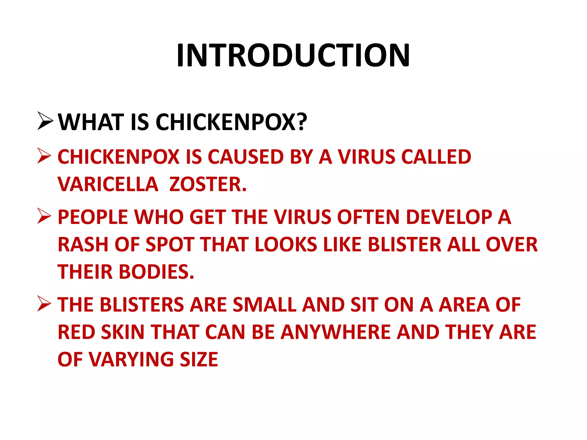 CHICKENPOX ppt | PPTX