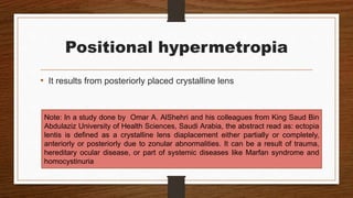 Hypermetropia/Hyperopia | PPTX