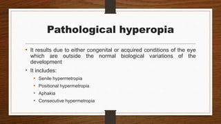 Hypermetropia/Hyperopia | PPTX