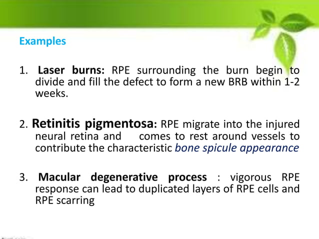 Suraj chhetri retina | PPT | Free Download