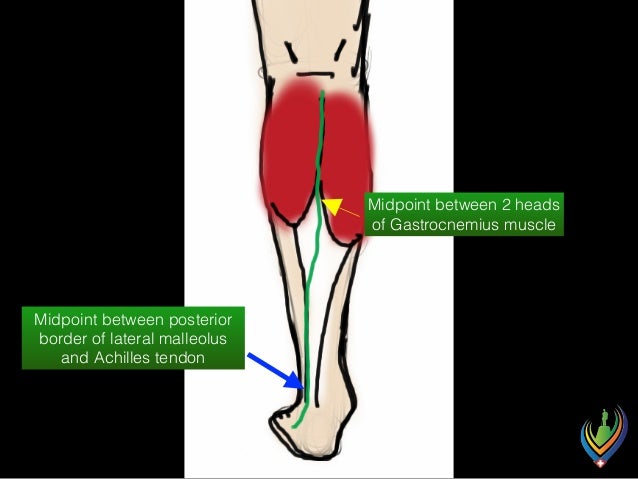 Sural Flap Anatomy Lower Extremity Flashcards | Quizlet