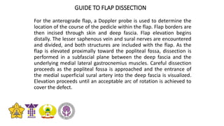 sural flap.pptx