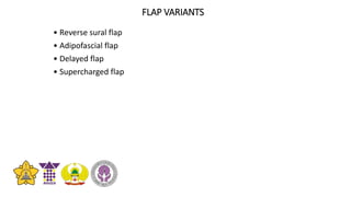 sural flap.pptx