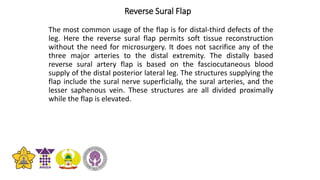 sural flap.pptx