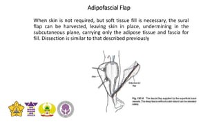 sural flap.pptx