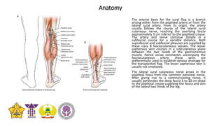 sural flap.pptx