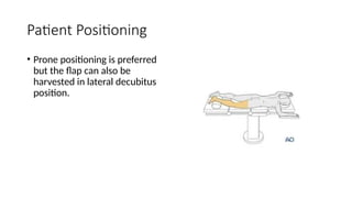 distally based sural artery flap for reconstruction of lower limb flap ...