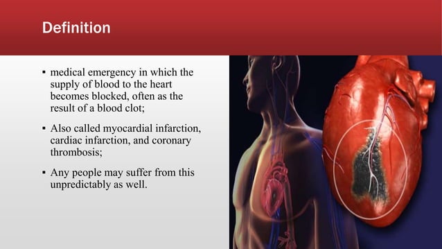 Heart Attack | PPT