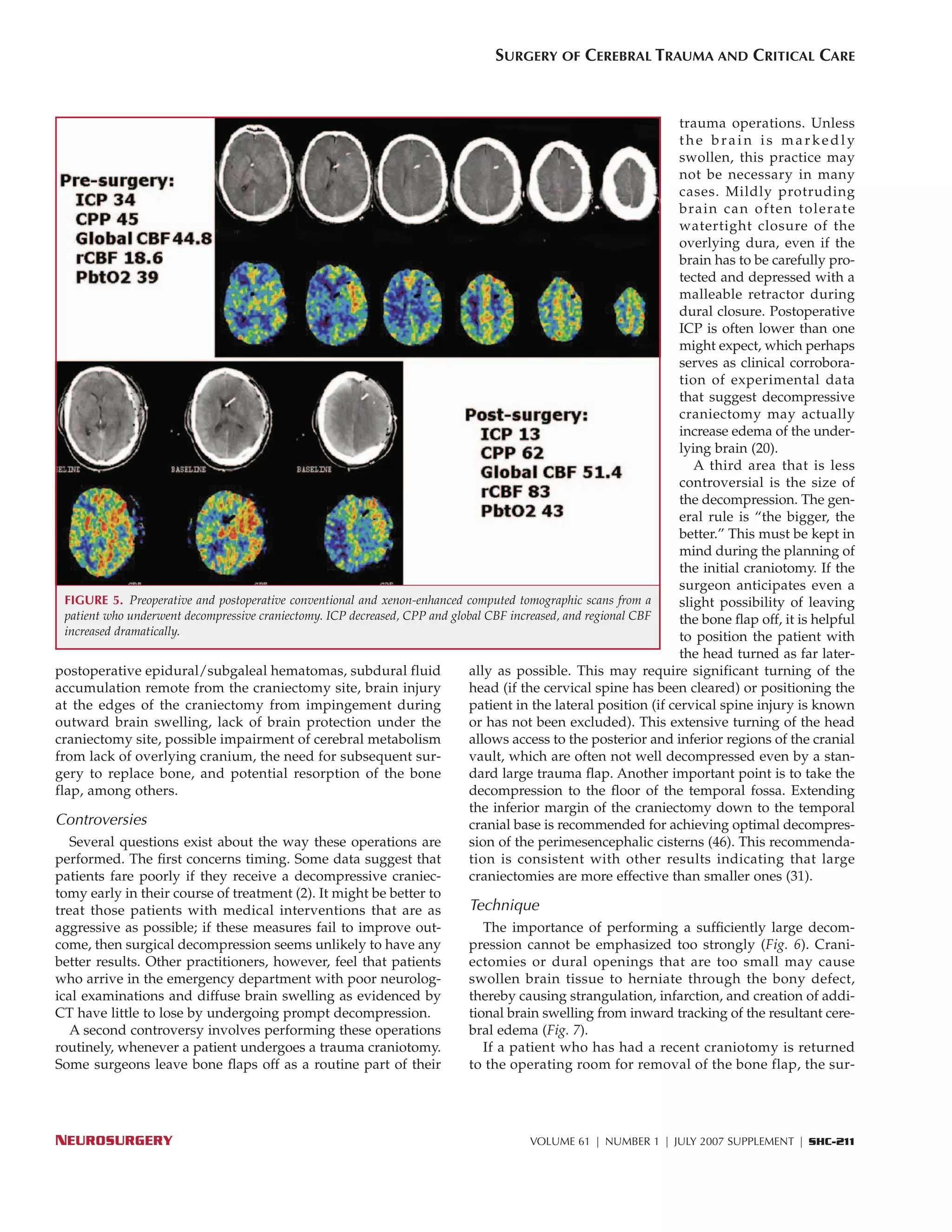 Surgery of cerebral trauma and associated critical care | PDF