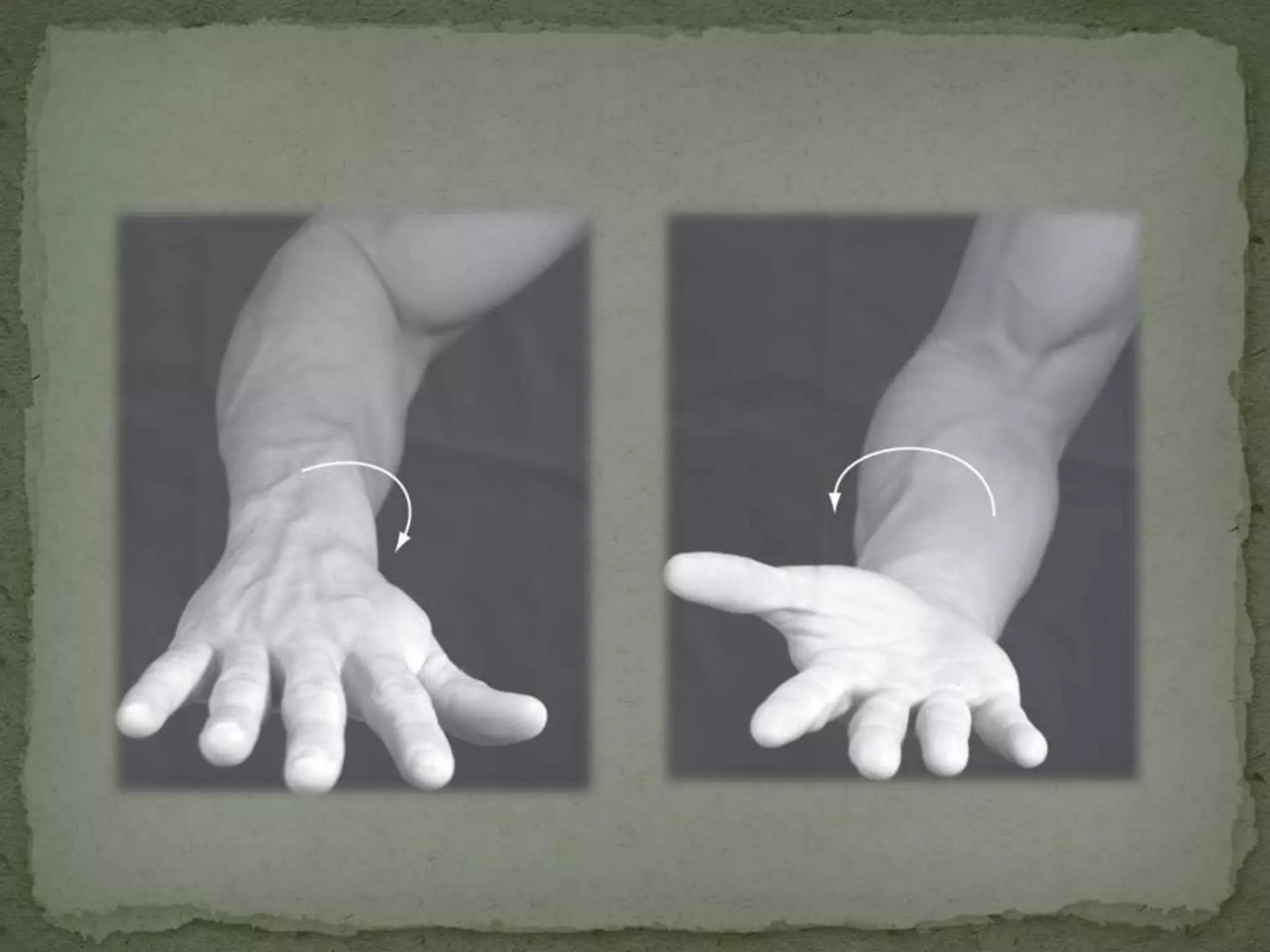 ELBOW JOINT X-RAY PROJECTIONS | PPTX