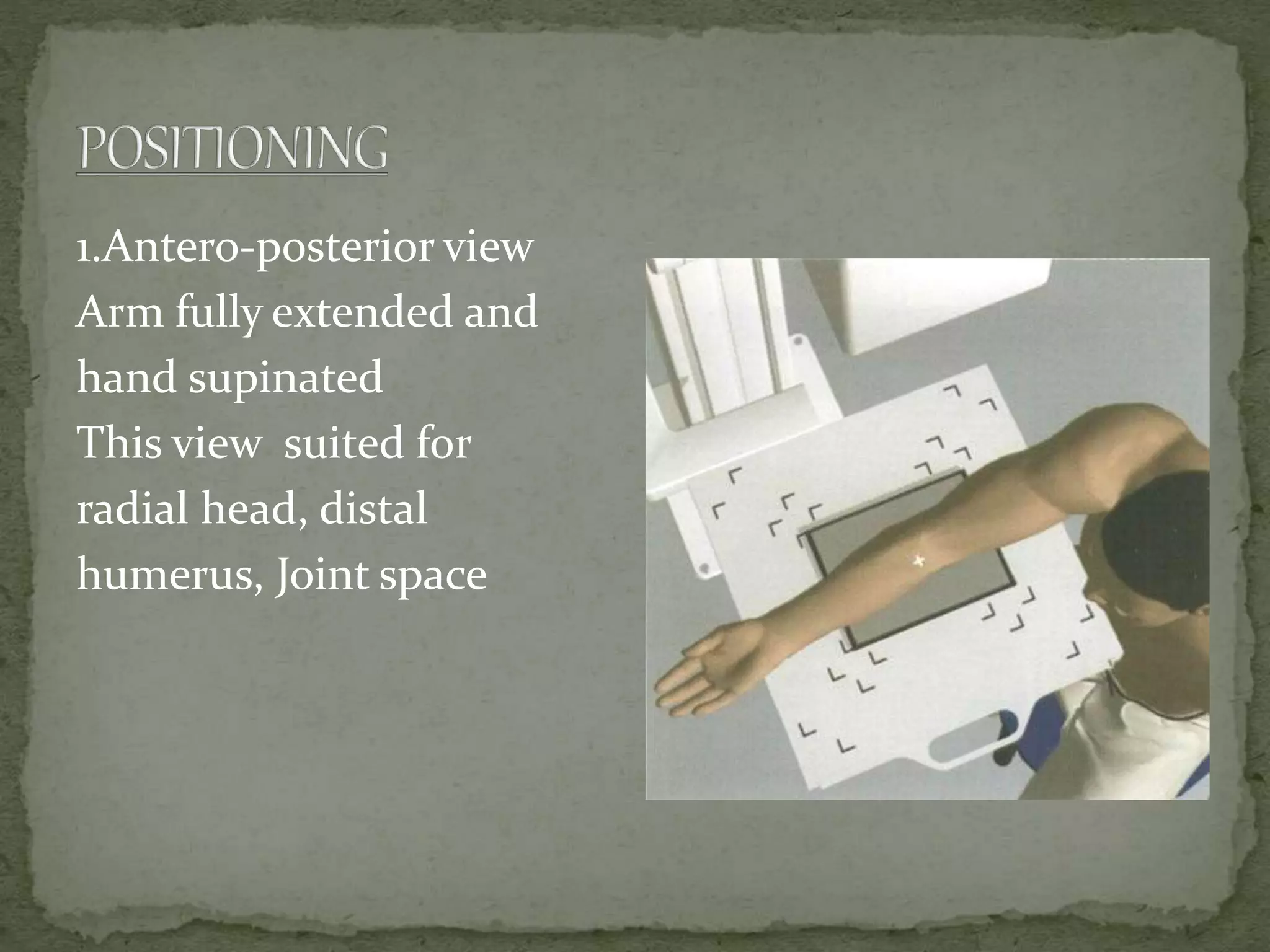 ELBOW JOINT X-RAY PROJECTIONS | PPTX
