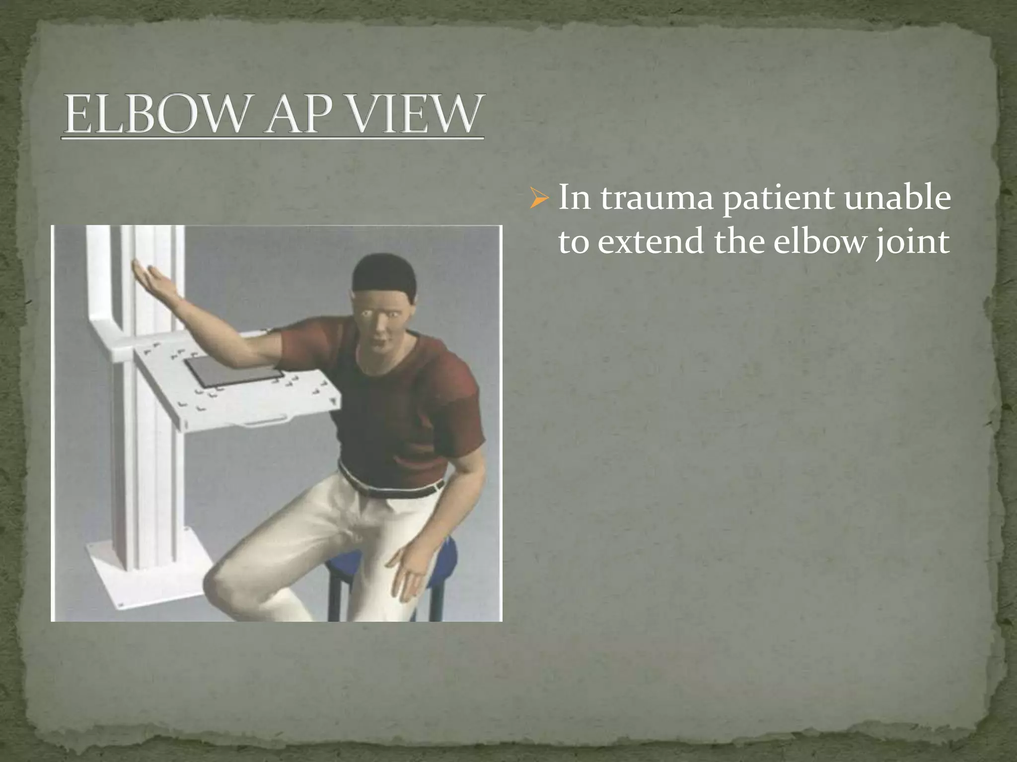 ELBOW JOINT X-RAY PROJECTIONS | PPTX