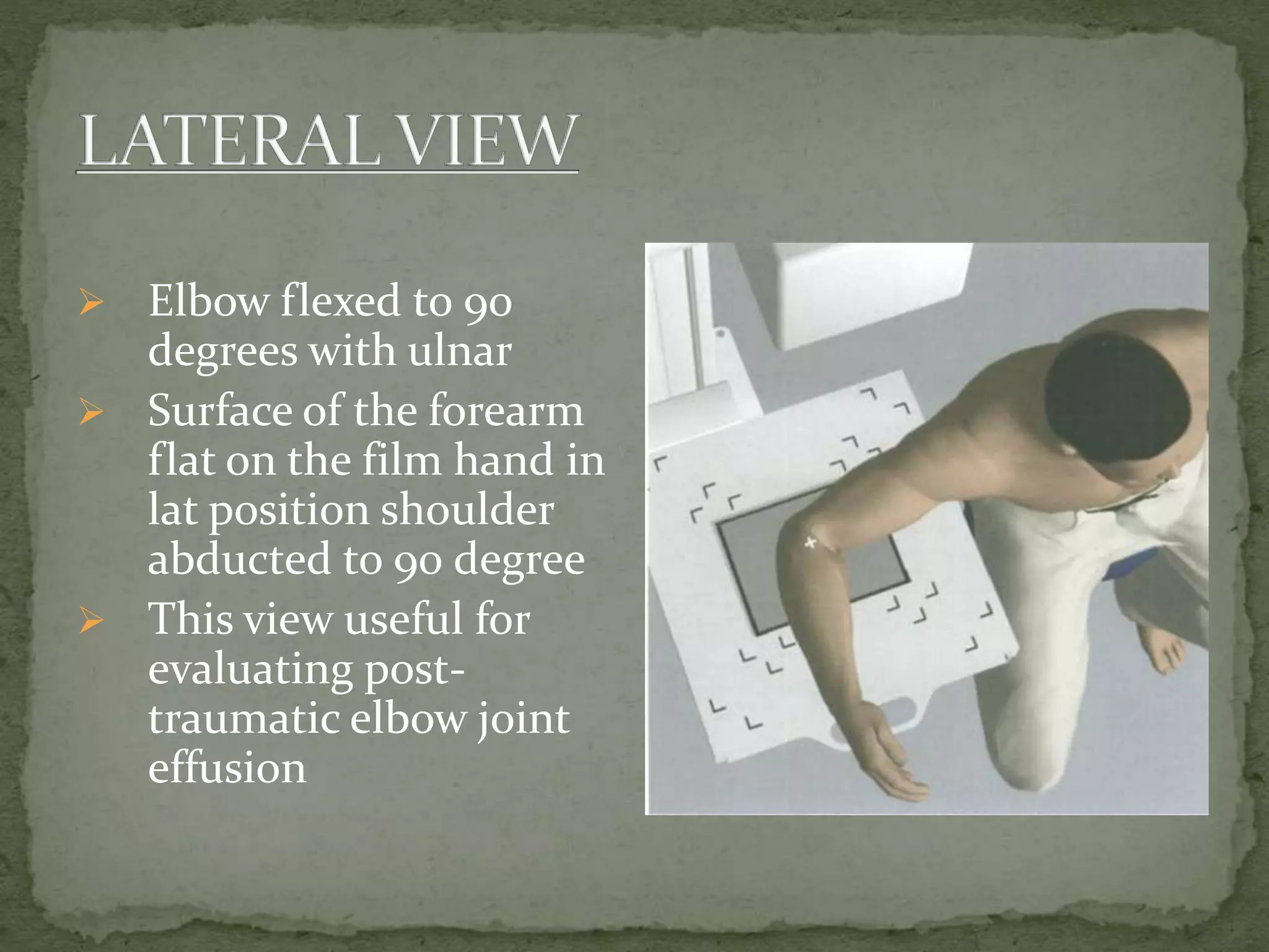 ELBOW JOINT X-RAY PROJECTIONS | PPTX