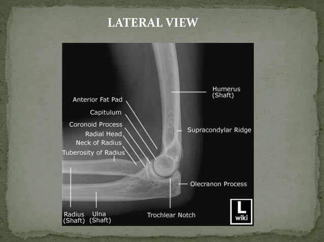 ELBOW JOINT X-RAY PROJECTIONS