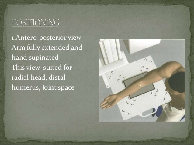 ELBOW JOINT X-RAY PROJECTIONS