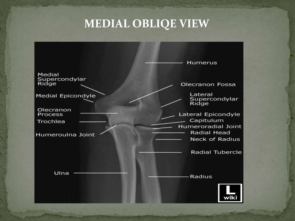 ELBOW JOINT X-RAY PROJECTIONS