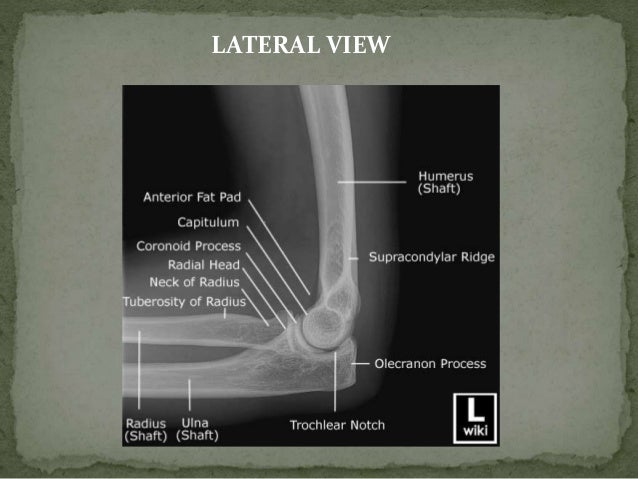 ELBOW JOINT X-RAY PROJECTIONS
